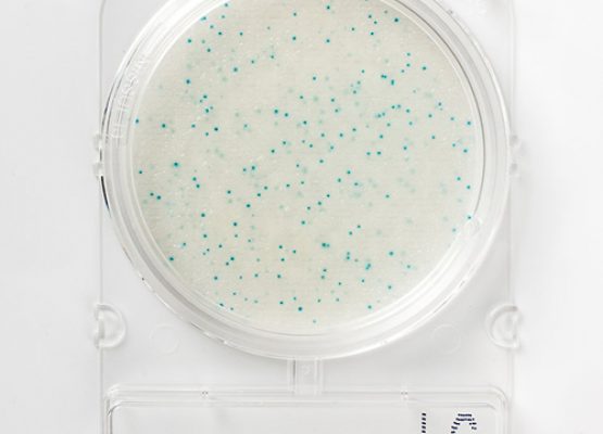 CLEAN CARD PRO - Hijyen Kontrol Kartı - HFS Mikrobiyoloji & Hijyen